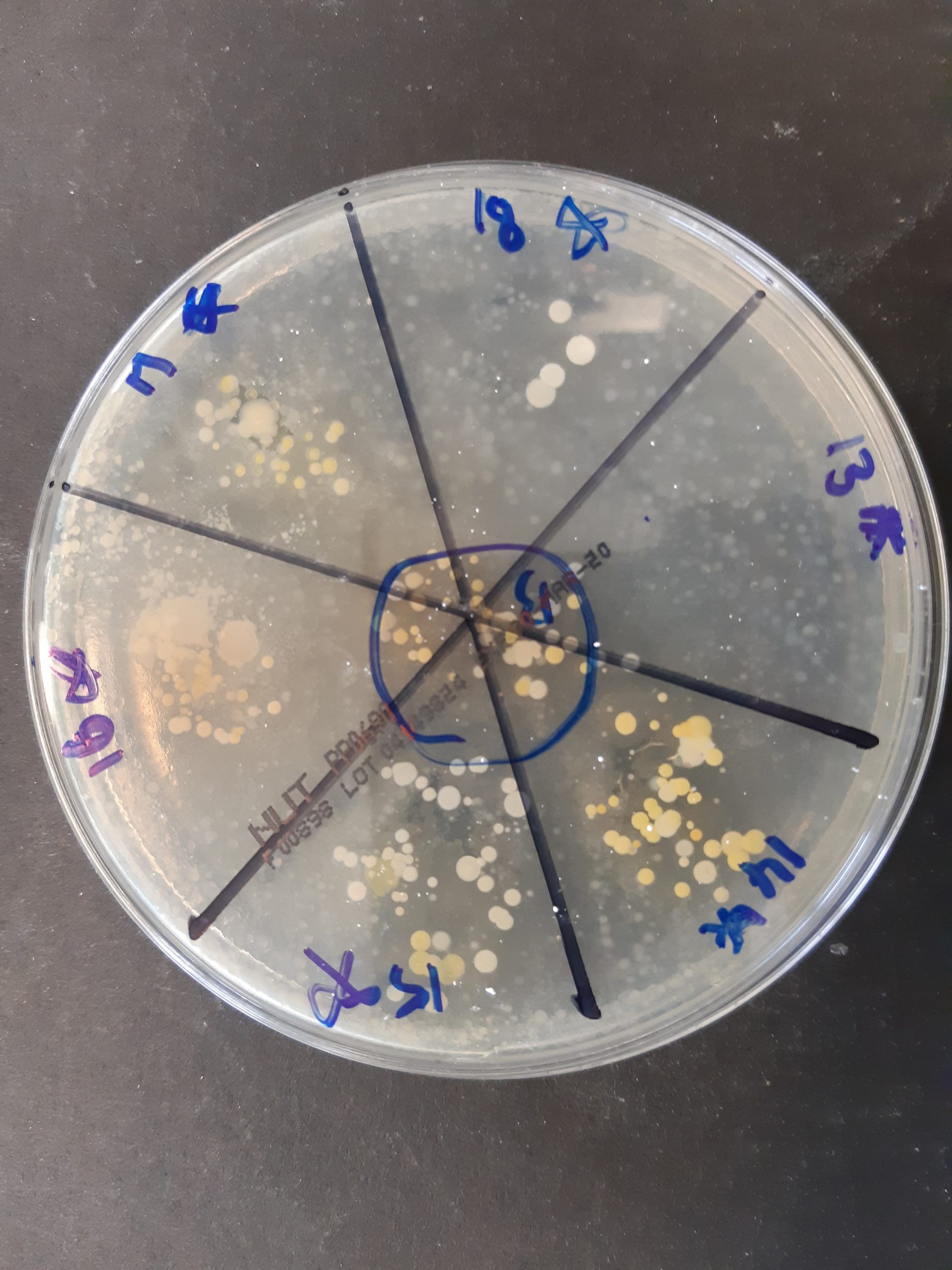 Rogue Cells – Techniquest, March 2020 – Show Me The Science